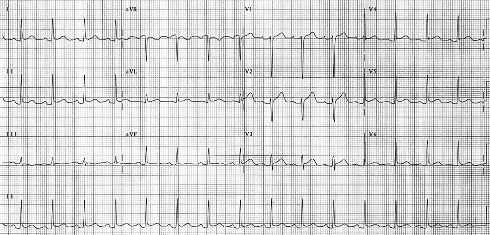BPT cardiology - Cardiovascular Clinical Courses, Melbourne